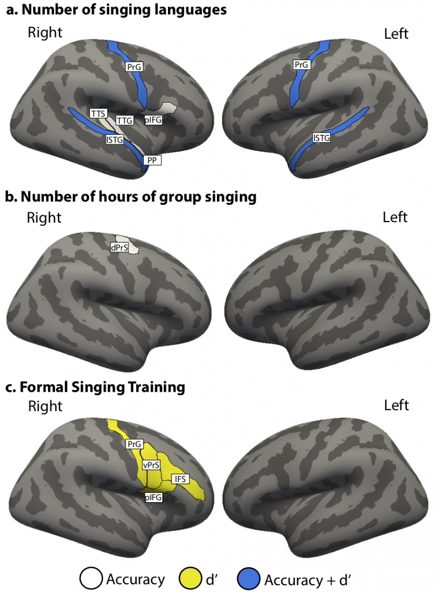Scientific Article on the Benefits of Choral Singing – Speechneurolab