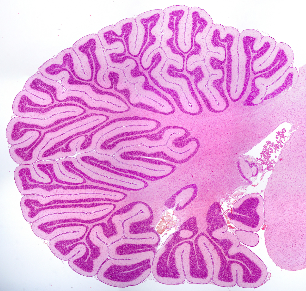 The anatomy of the human brain – Speechneurolab