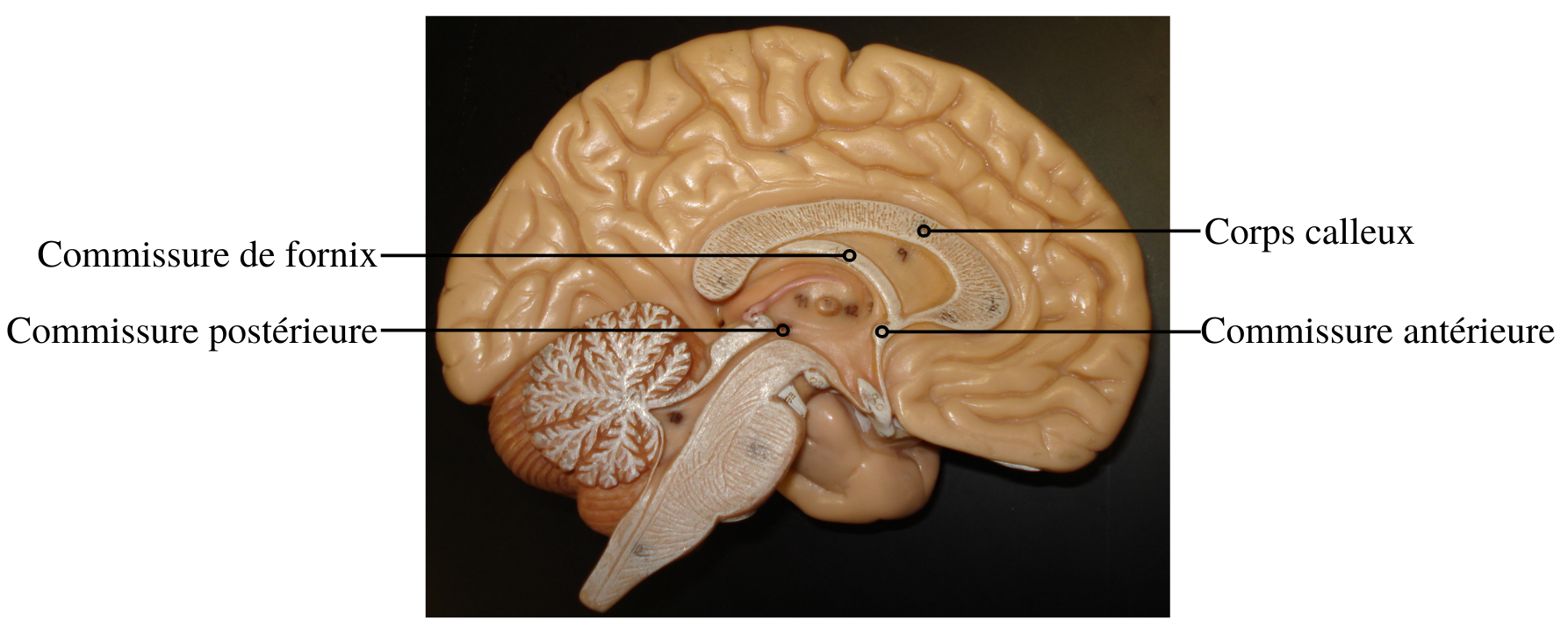 La matière grise et blanche – Speechneurolab
