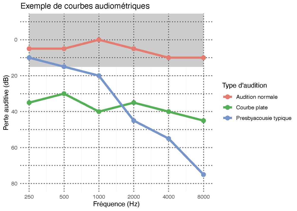 Les mécanismes physiopathologiques de la presbyacousie – Speechneurolab