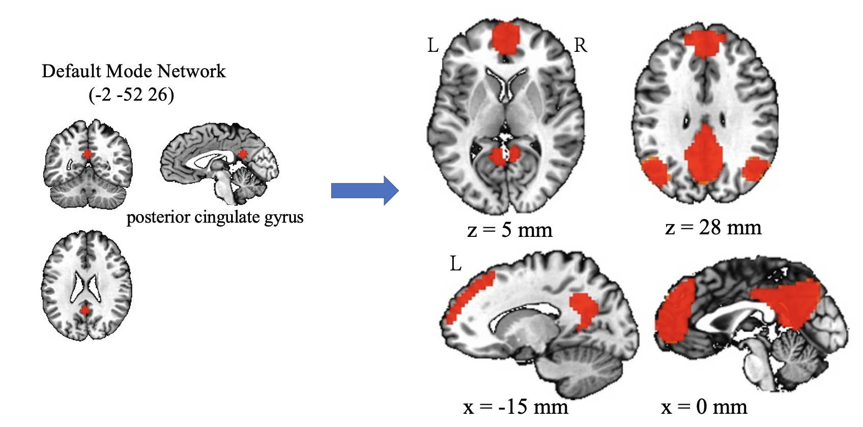 New Scientific Article on the Impact of Singing on Brain Networks ...