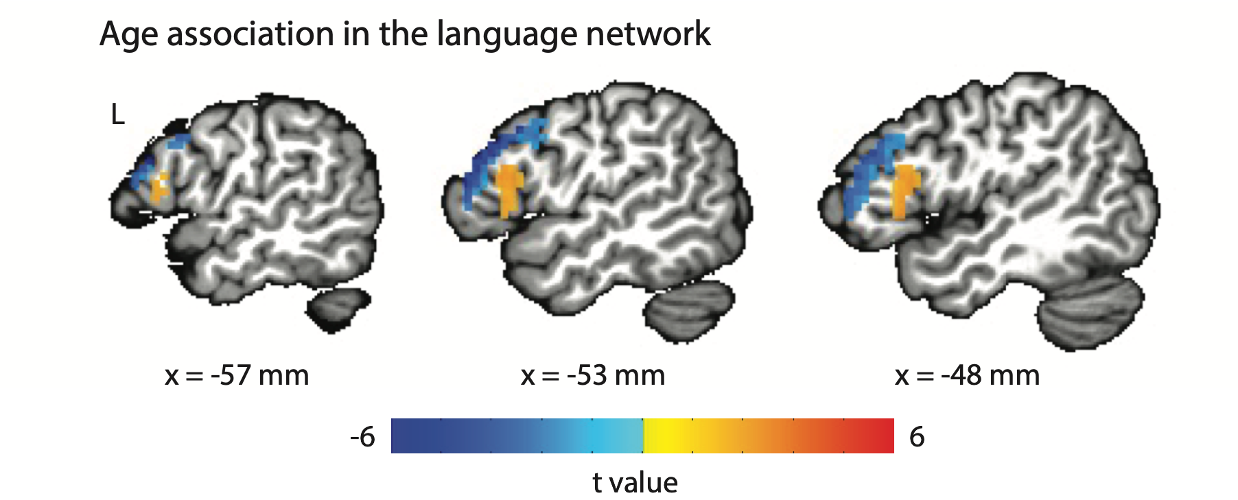 New Scientific Article on the Impact of Singing on Brain Networks ...