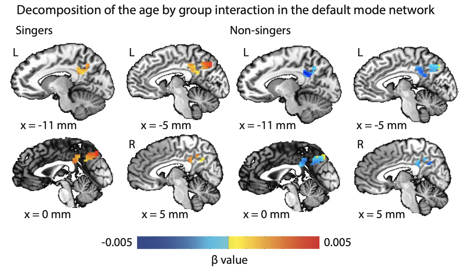 New Scientific Article on the Impact of Singing on Brain Networks ...