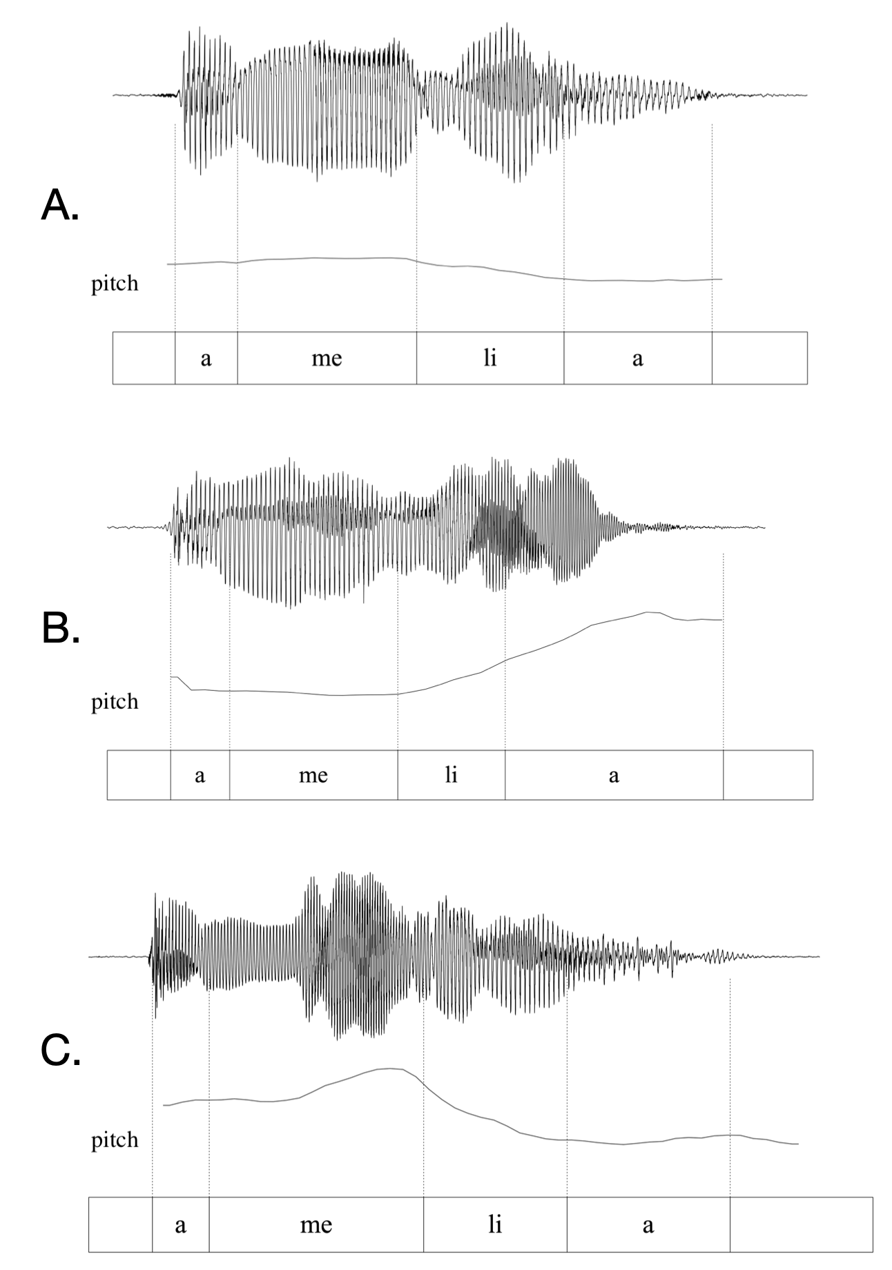 What is prosody? – Speechneurolab