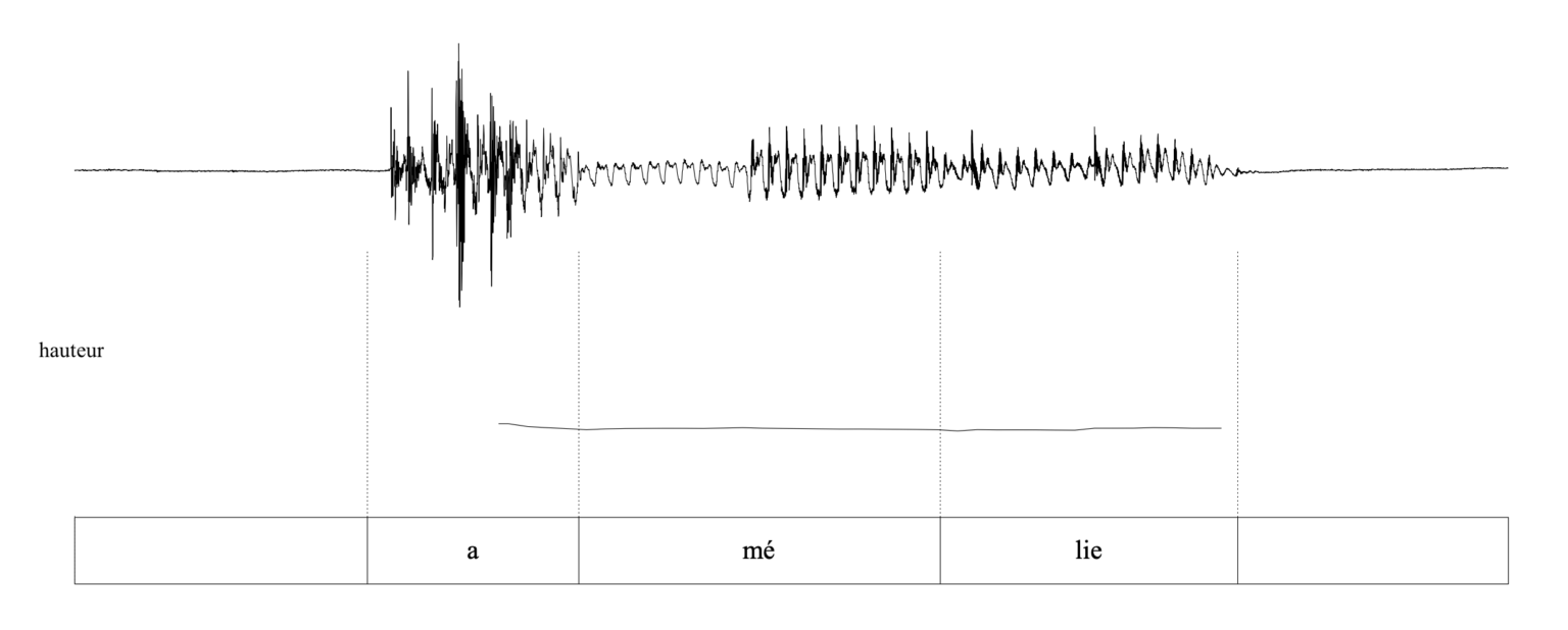 Qu’est-ce que la prosodie ? – Speechneurolab