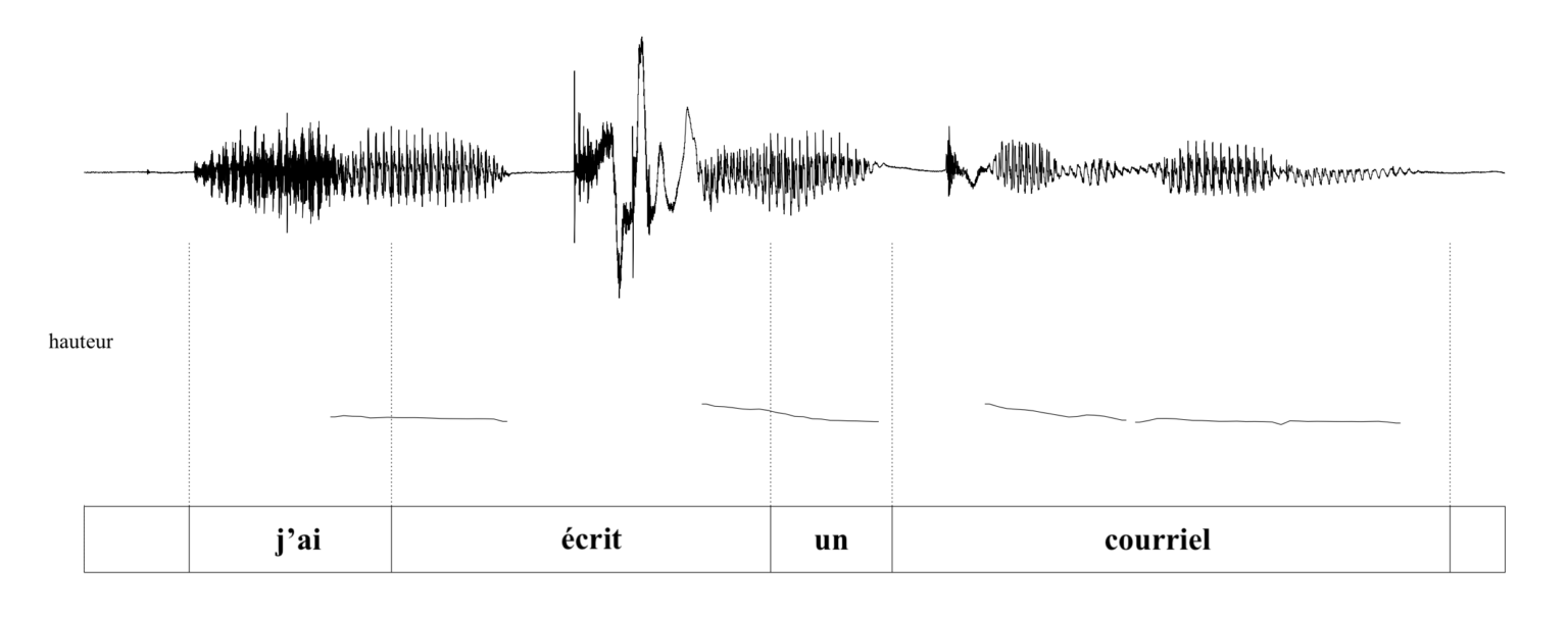 Qu’est-ce que la prosodie ? – Speechneurolab