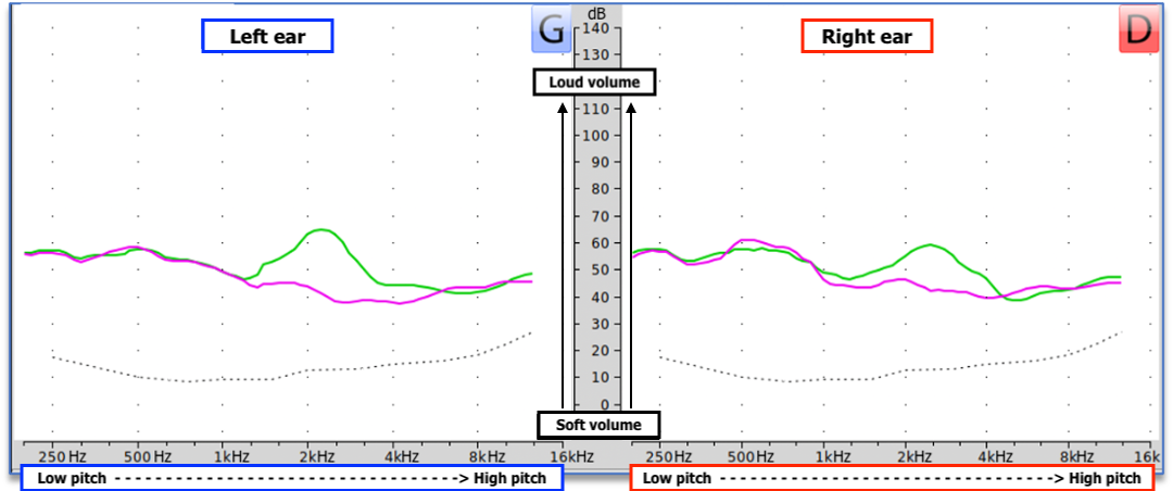Speech Perception in Noise: Facilitatory Mechanisms of the Peripheral ...